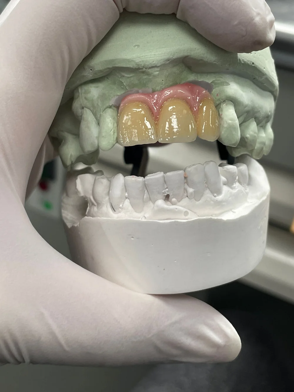 Techniform Dental | Case Studies - Techniform Dental